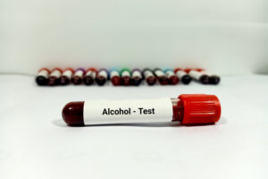 How Reliable Are Blood Alcohol Test Results? - Eric G Johnson Law